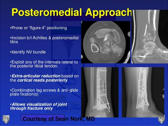 Lecture 11 parekh pilon