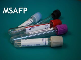 Lecture 11 Prenatal diagnosis | PPTX