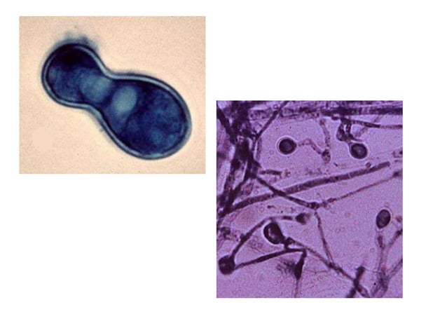Lecture 12- Medical Mycology- Blastomycosis.ppt