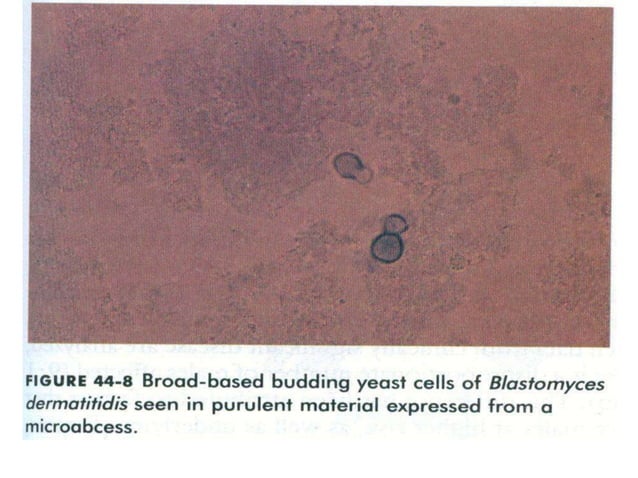 Lecture 12- Medical Mycology- Blastomycosis.ppt