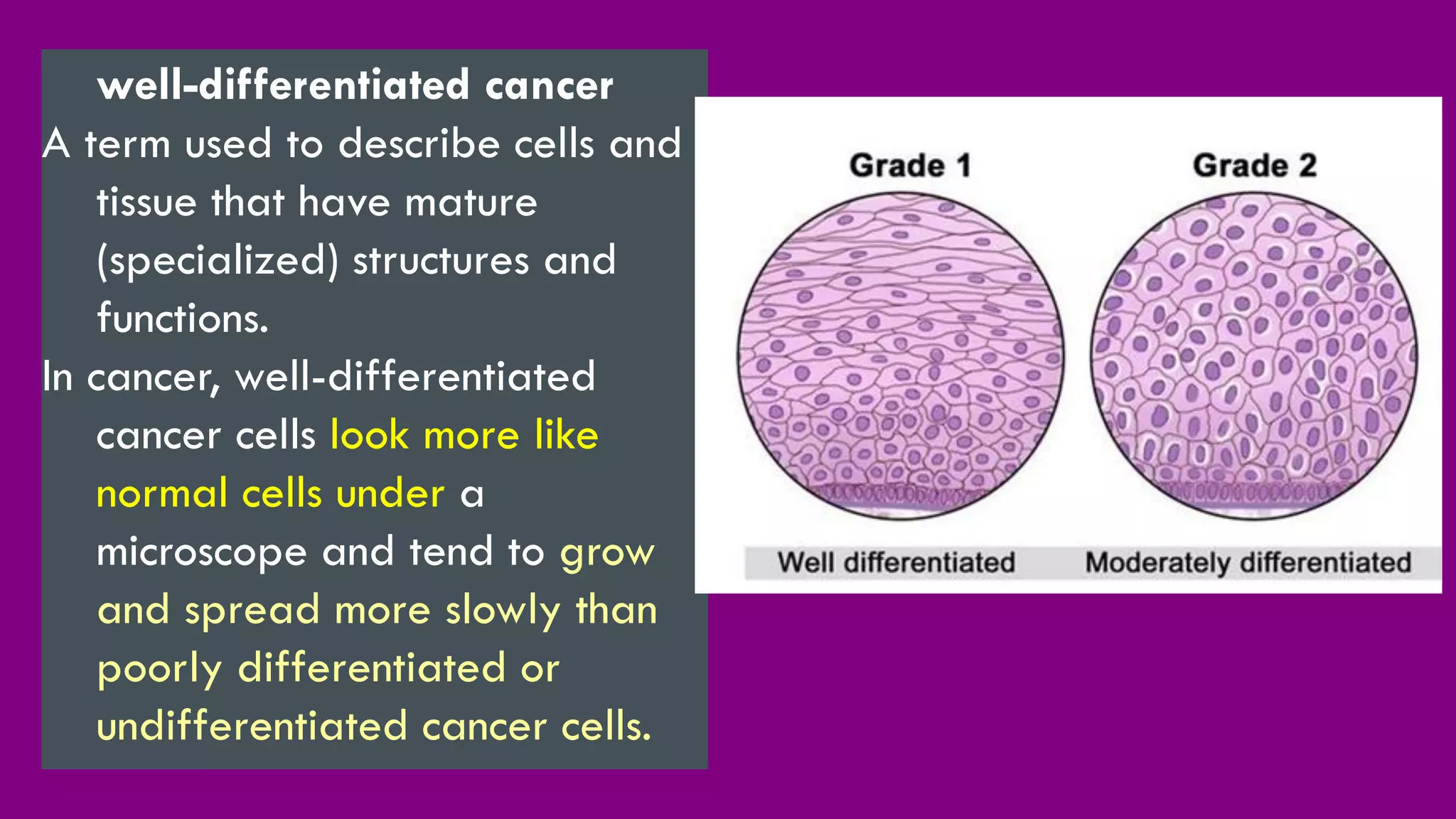 Osteosarcoma.pdf