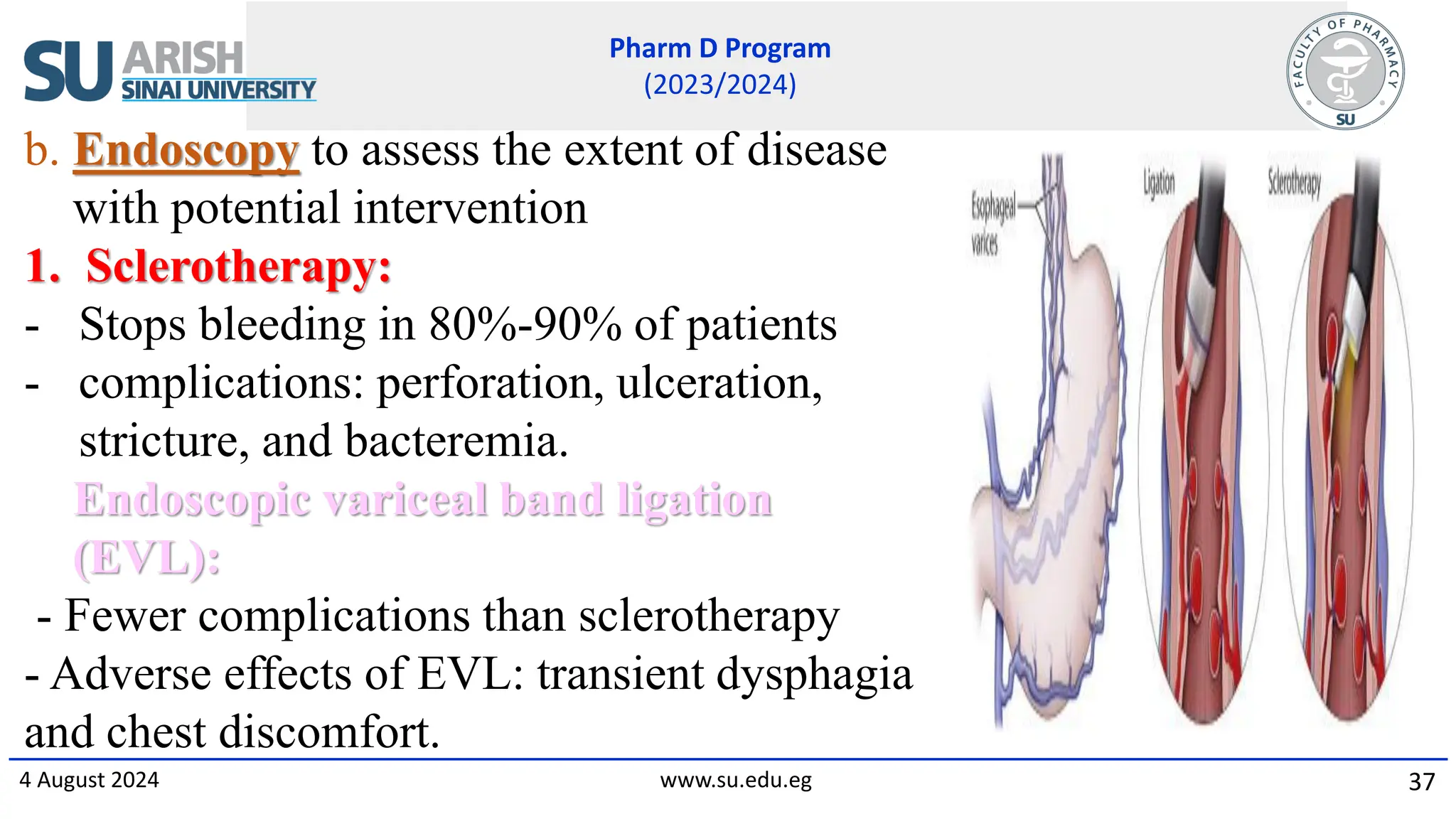 Lecture 12 Complications of liver disease.pdf
