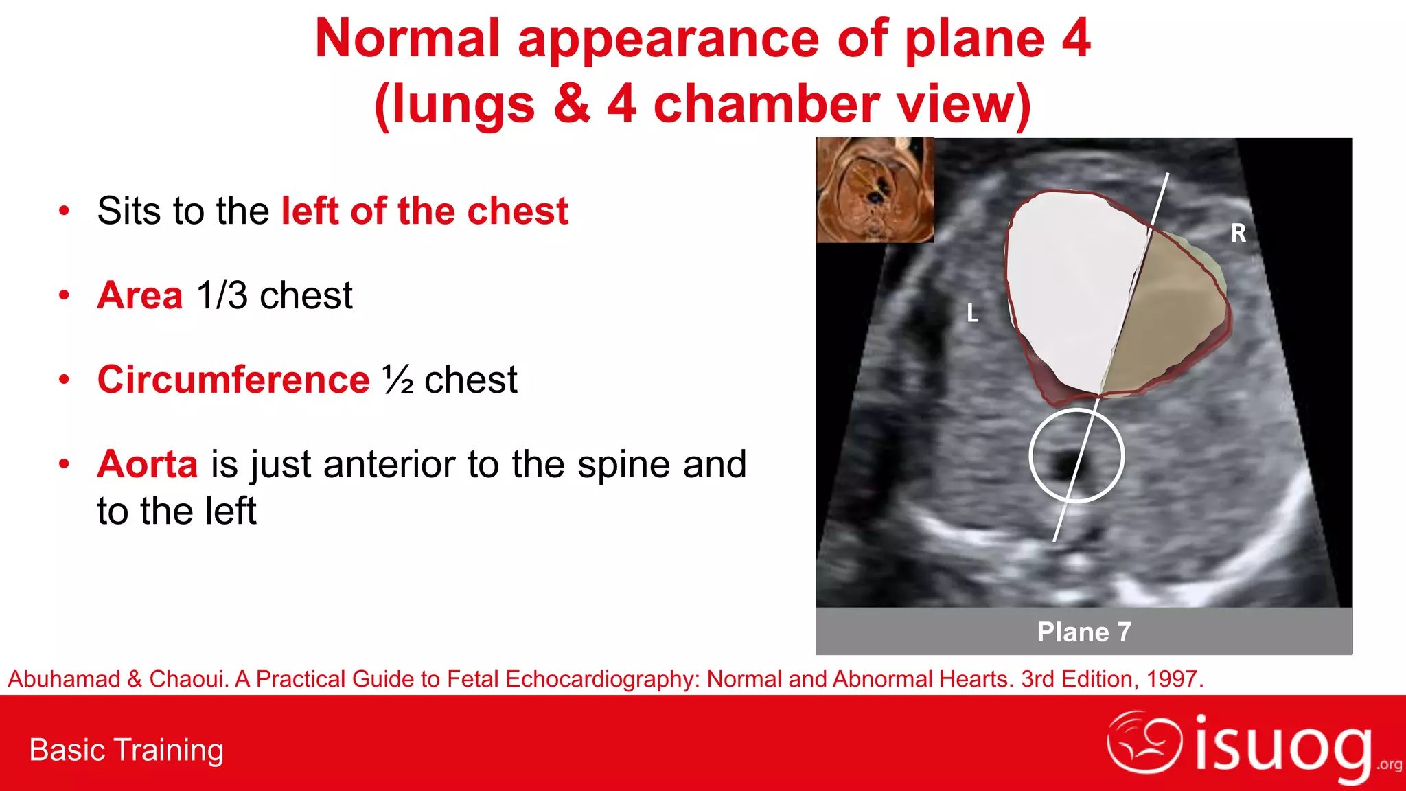 Lecture 12 distinguishing between normal and abnormal appearances of ...