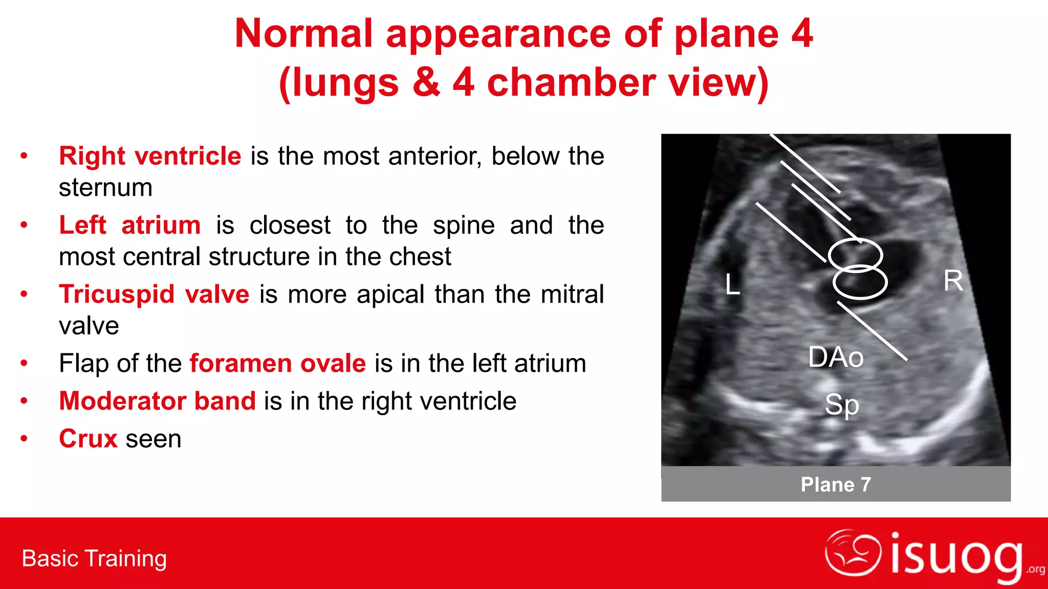 Lecture 12 distinguishing between normal and abnormal appearances of ...