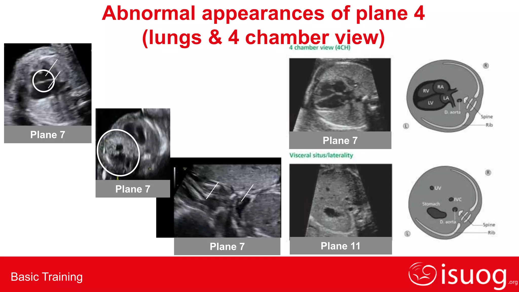 Lecture 12 distinguishing between normal and abnormal appearances of ...