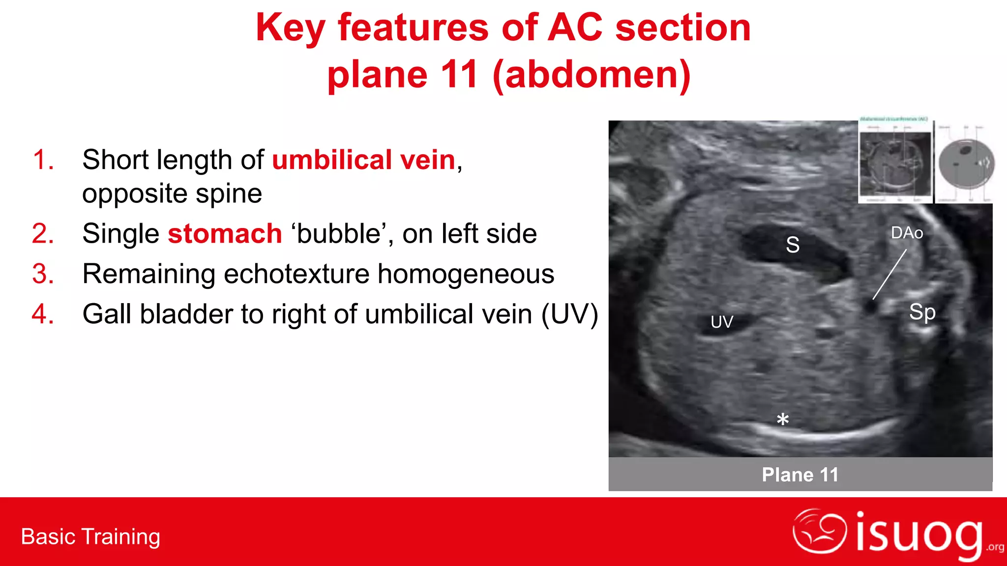 Lecture 12 distinguishing between normal and abnormal appearances of ...