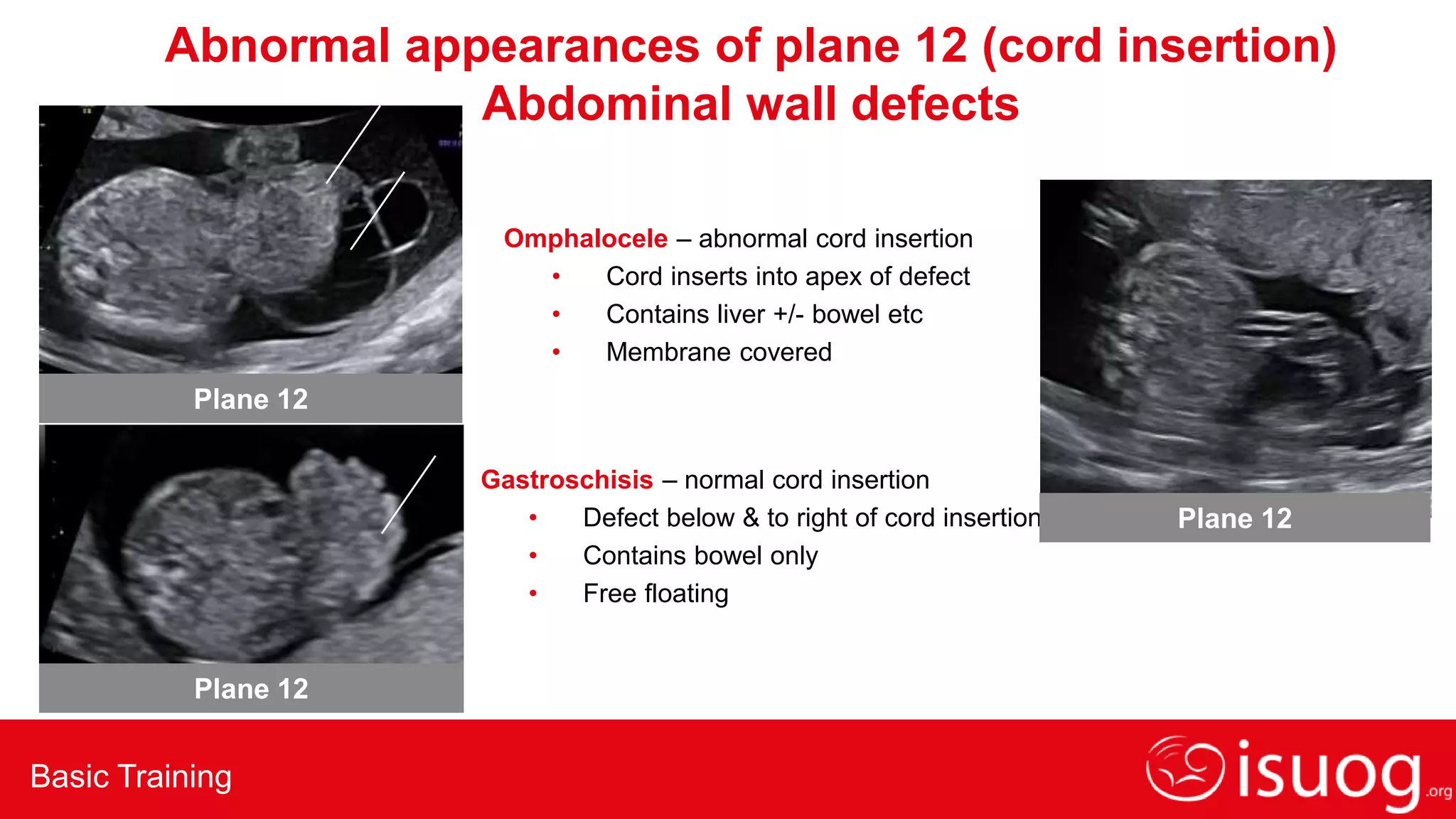 Lecture 12 distinguishing between normal and abnormal appearances of ...