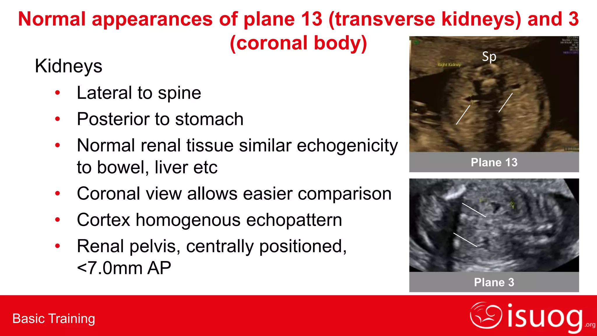 Lecture 12 distinguishing between normal and abnormal appearances of ...