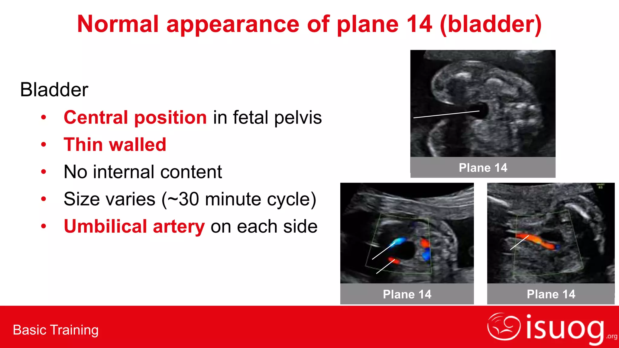 Lecture 12 distinguishing between normal and abnormal appearances of ...