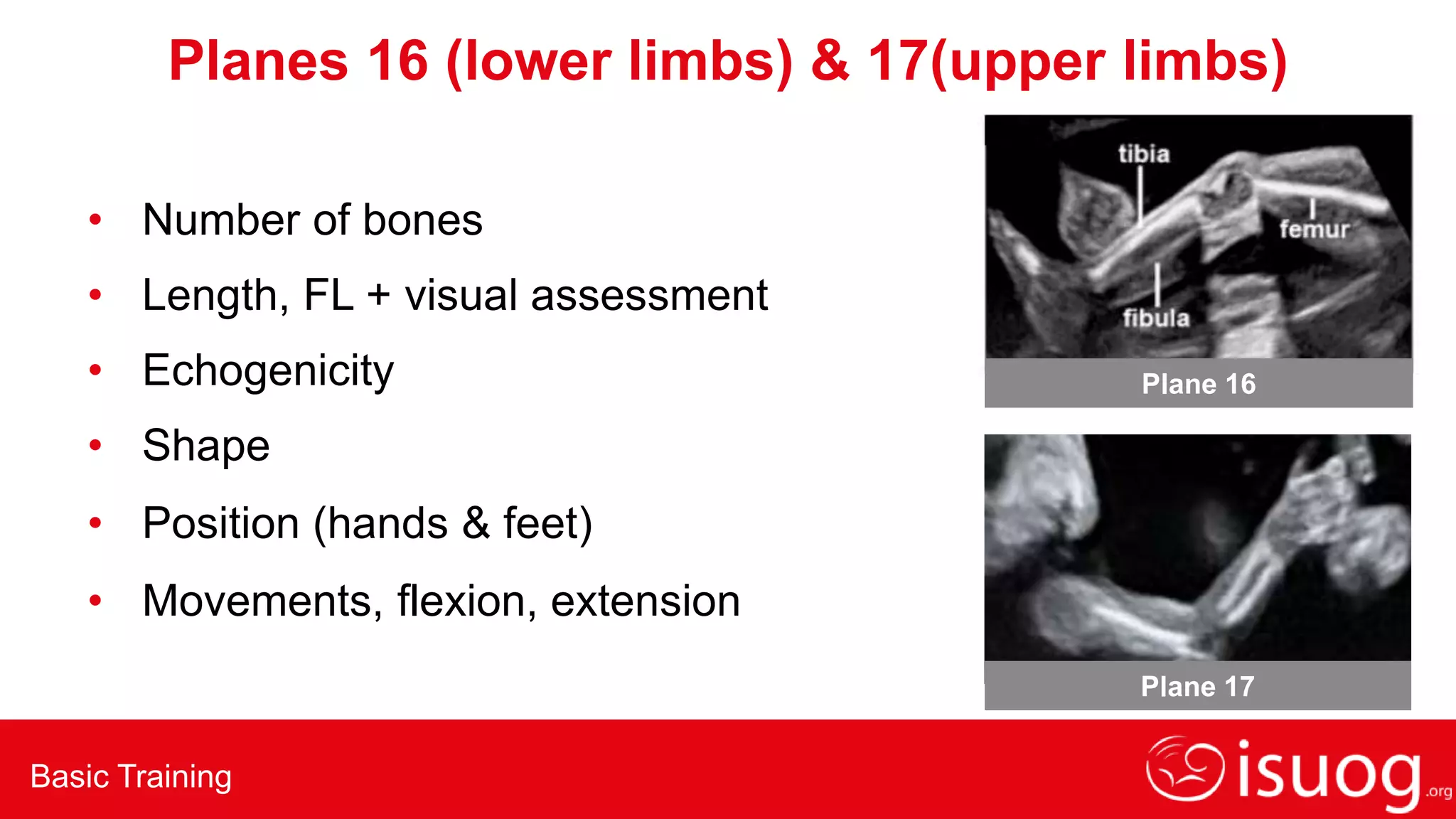 Lecture 12 distinguishing between normal and abnormal appearances of ...