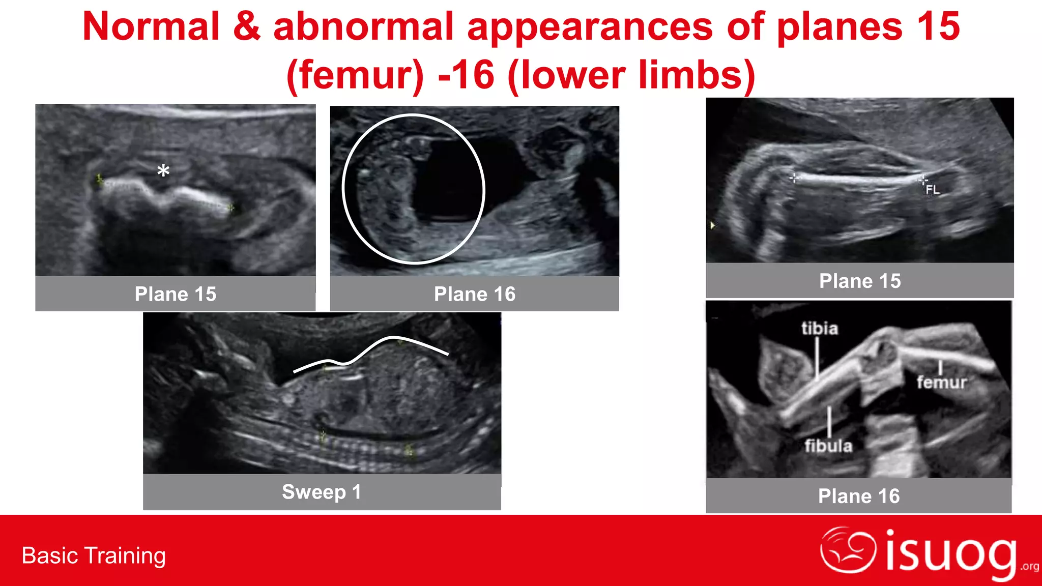 Lecture 12 distinguishing between normal and abnormal appearances of ...
