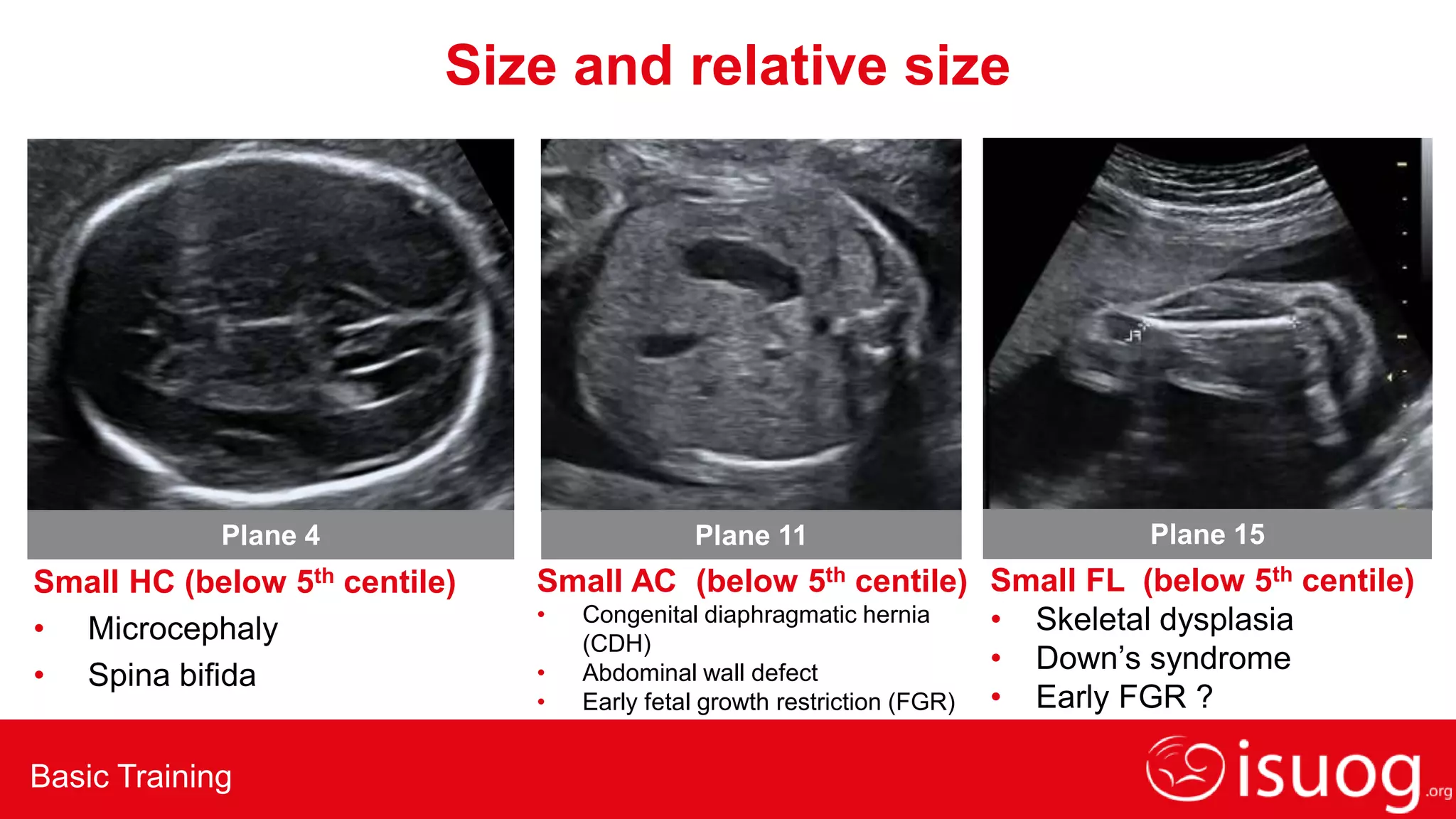 Lecture 12 distinguishing between normal and abnormal appearances of ...