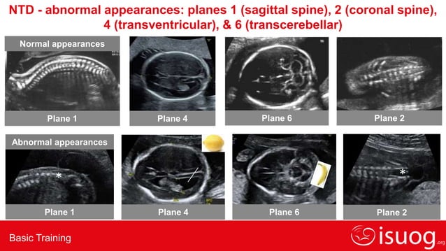 Lecture 12 distinguishing between normal and abnormal appearances of ...