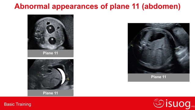 Lecture 12 distinguishing between normal and abnormal appearances of ...