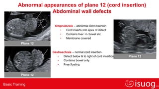 Lecture 12 distinguishing between normal and abnormal appearances of ...