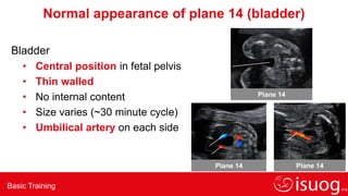 Lecture 12 distinguishing between normal and abnormal appearances of ...