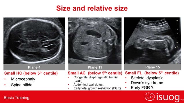 Lecture 12 distinguishing between normal and abnormal appearances of ...