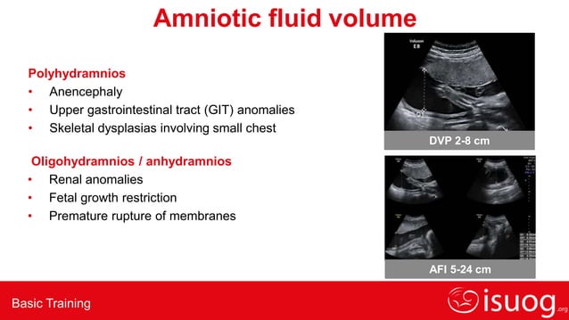Lecture 12 distinguishing between normal and abnormal appearances of ...