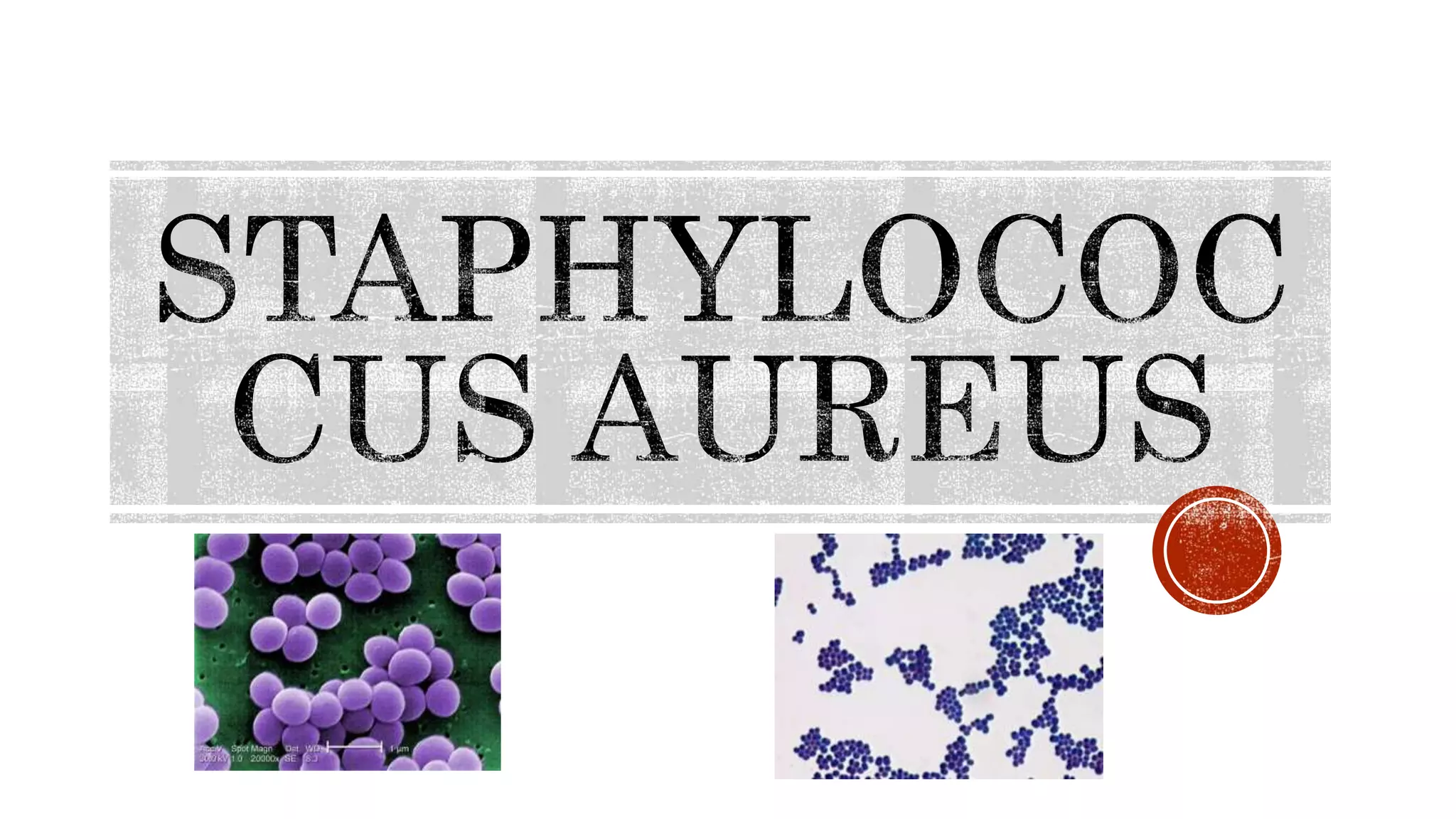 Lecture 12 (G+ & G- cocci ;STAPH& NEISSERIA).pptx