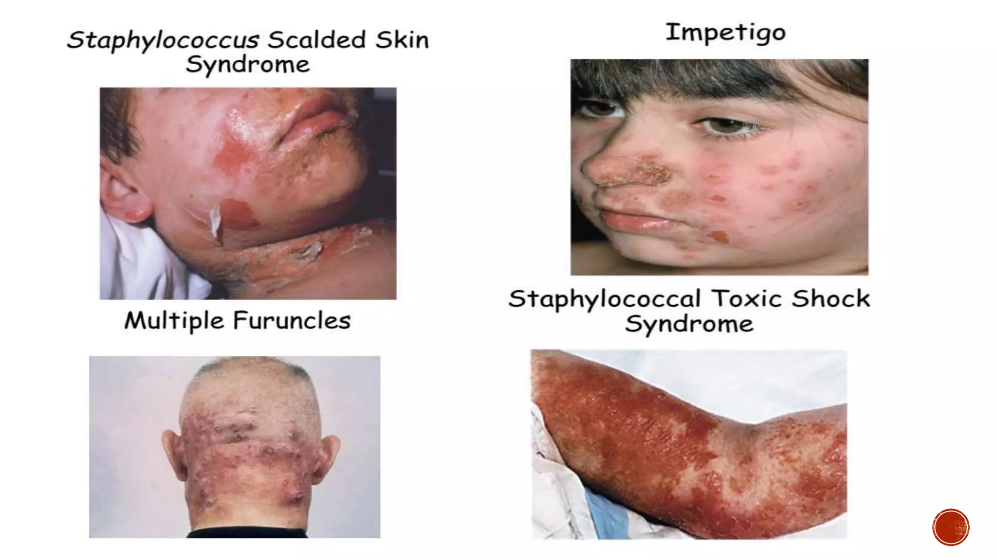 Lecture 12 (G+ & G- cocci ;STAPH& NEISSERIA).pptx