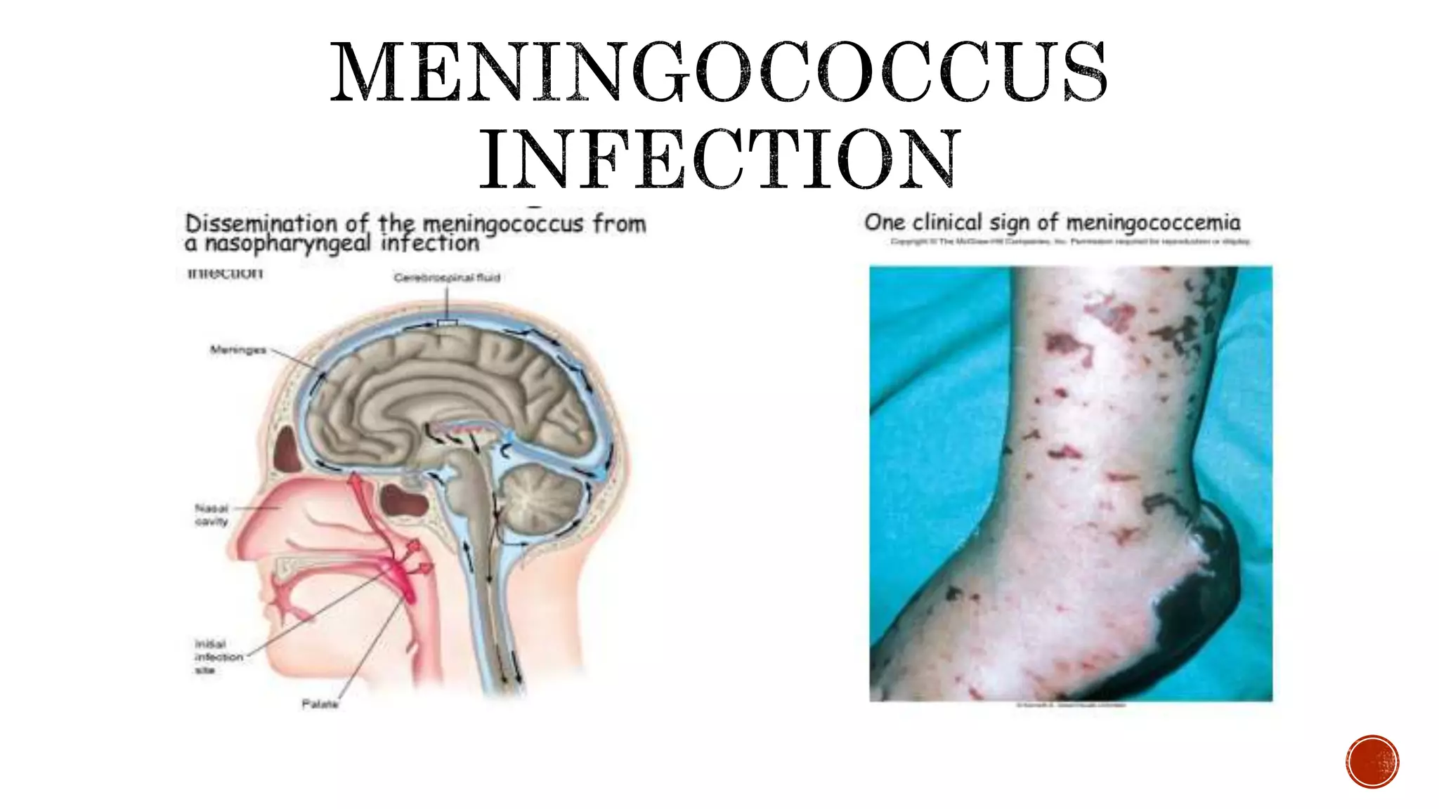 Lecture 12 (G+ & G- cocci ;STAPH& NEISSERIA).pptx