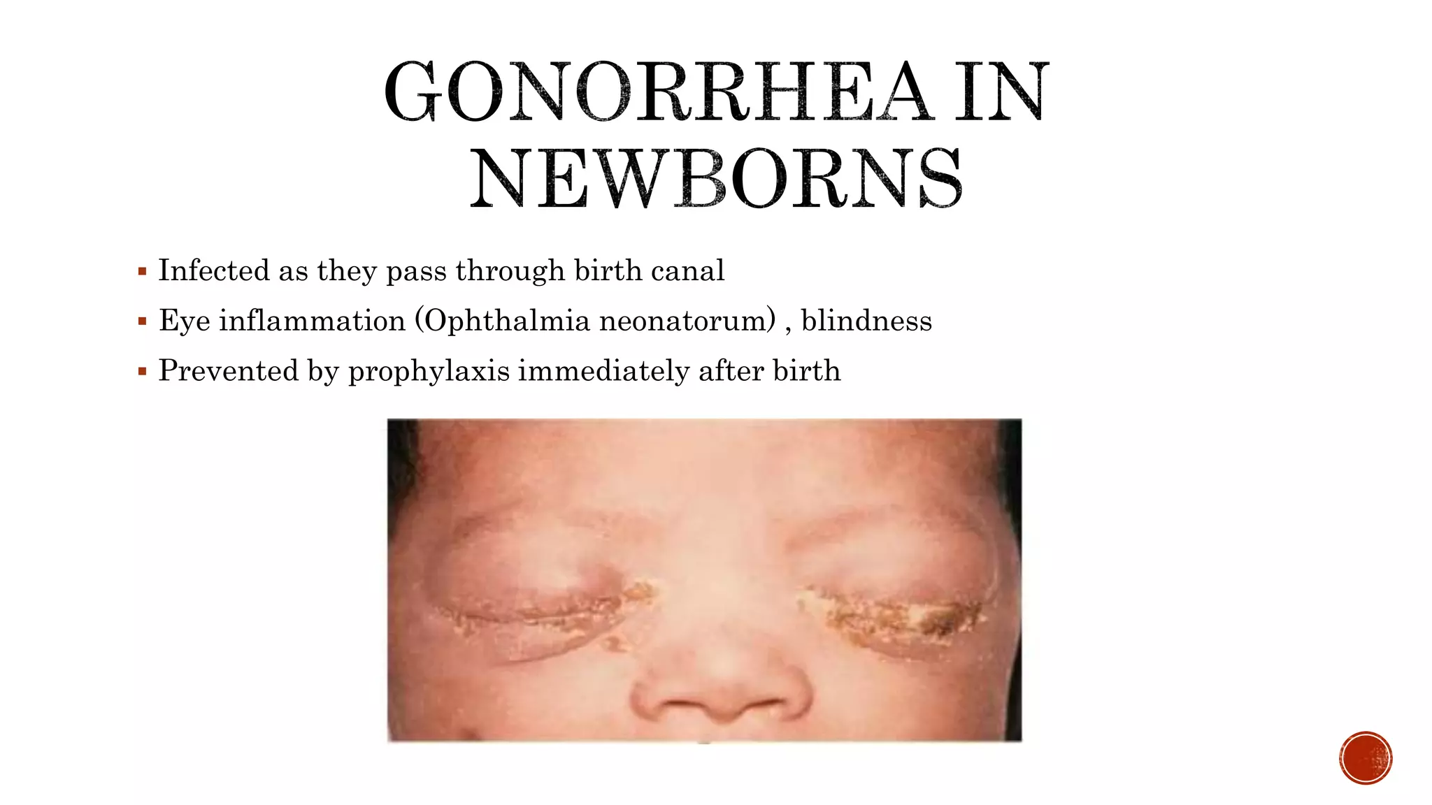 Lecture 12 (G+ & G- cocci ;STAPH& NEISSERIA).pptx