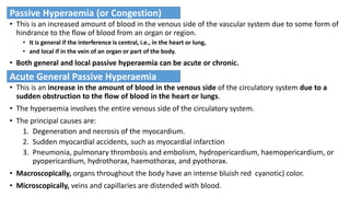 Lecture # 12 HYPERAEMIA AND CONGESTION.pdf