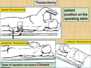 Lecture 12 Topographic anatomy of the chest.pdf