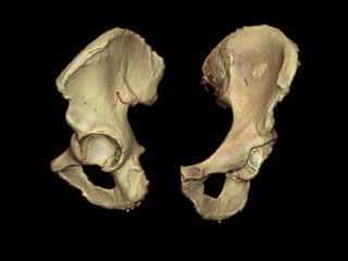 Radiological anatomy of the hip joint.pptx
