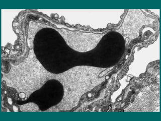 Lecture13 microscopic structure of the respiratory | PPT
