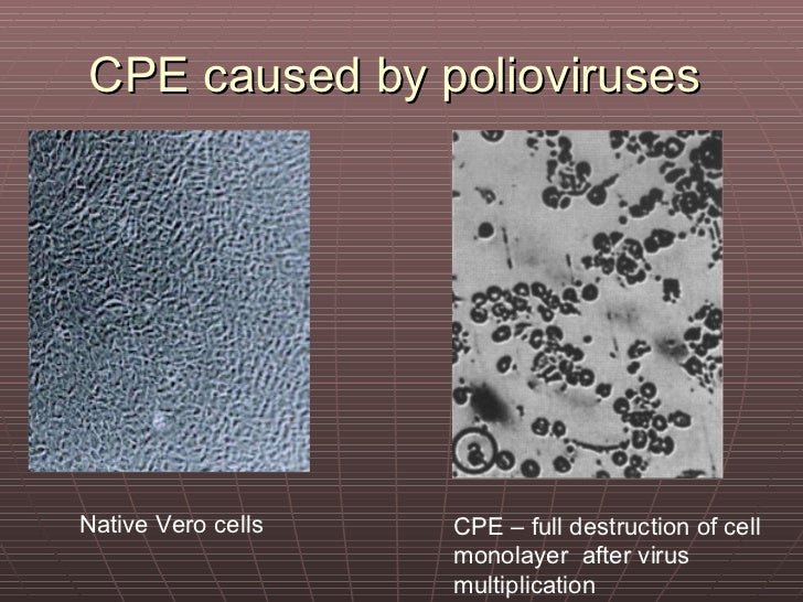 Bohomolets Microbiology Lecture #13