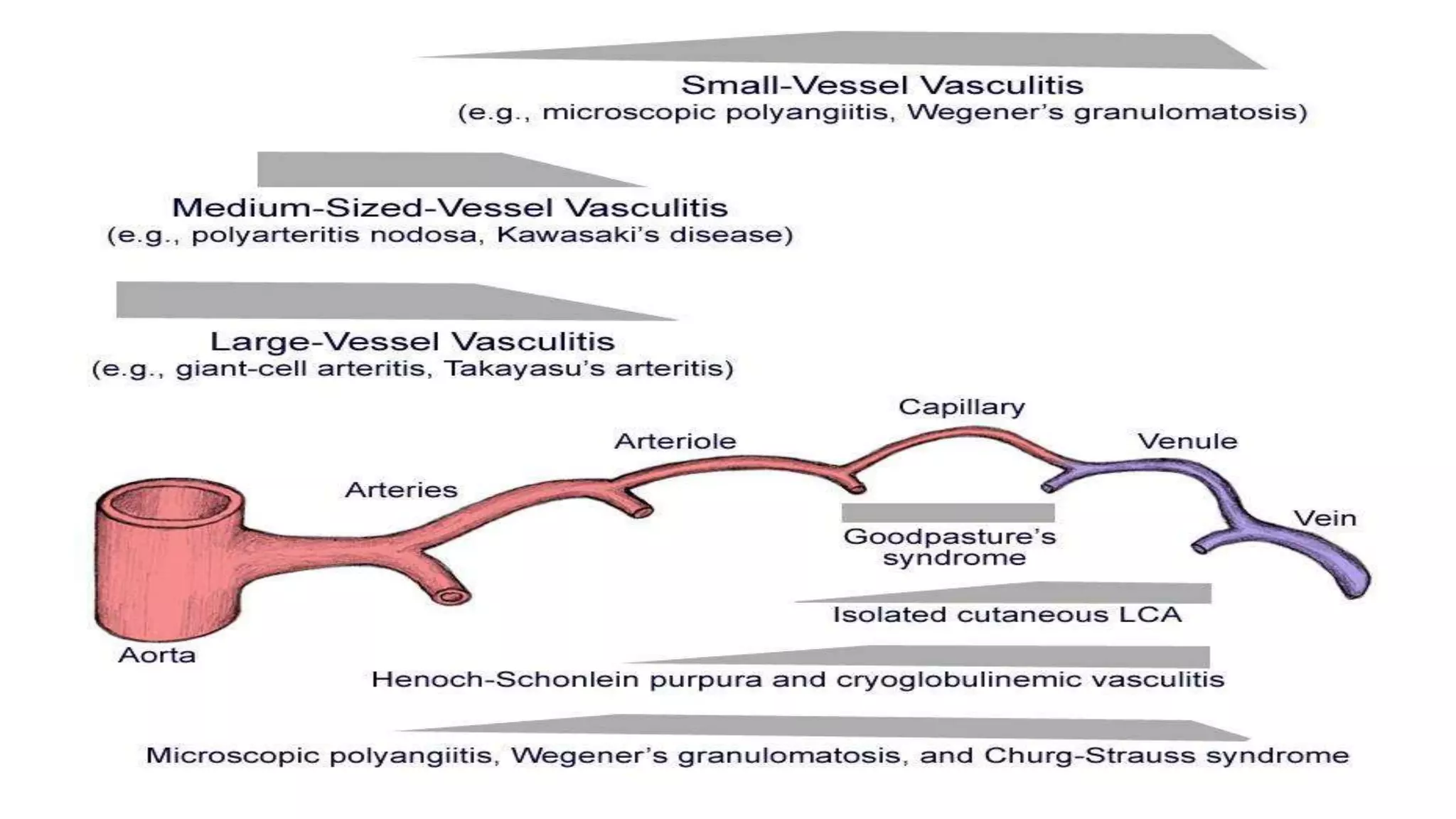 Lecture_13,14 Vasculitis and JIA.pptx