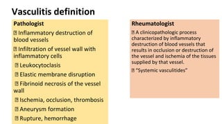 Lecture_13,14 Vasculitis and JIA.pptx