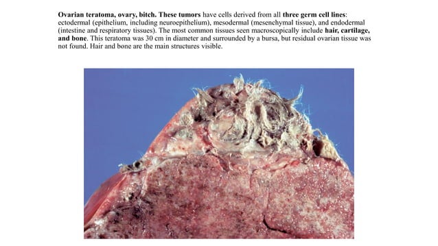 Pathology of Female Reproductive System | PDF | Pregnancy ...