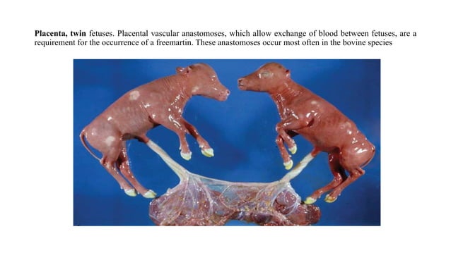 Pathology of Female Reproductive System | PDF | Pregnancy ...