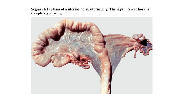 Pathology of Female Reproductive System | PDF | Pregnancy ...