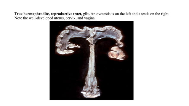 Pathology of Female Reproductive System | PDF | Pregnancy ...