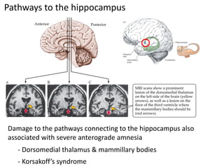 Introduction to neuroscience presentation on memory and learning | PPT
