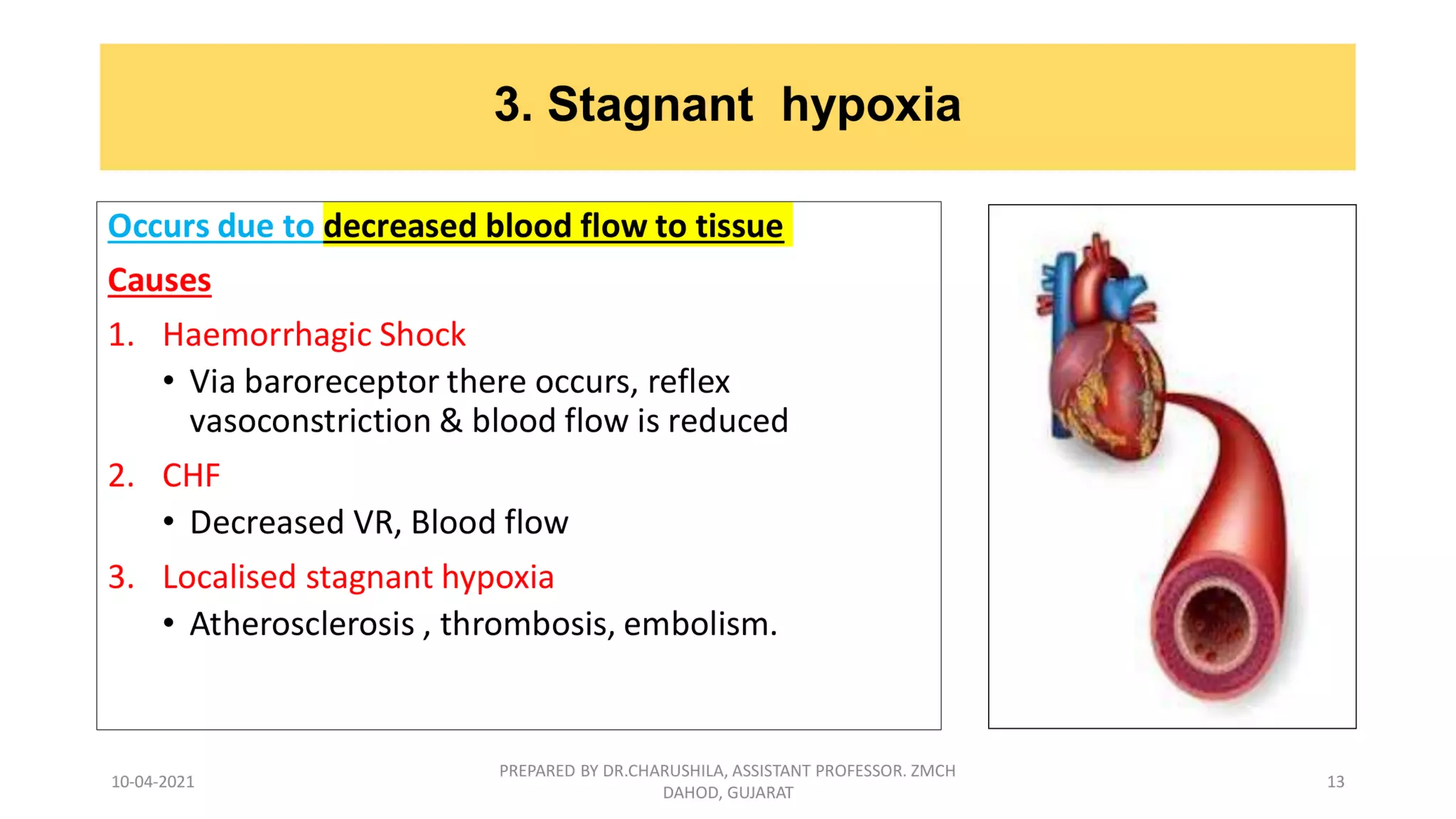 HYPOXIA: Applied aspect of respiratory sysstem | PDF