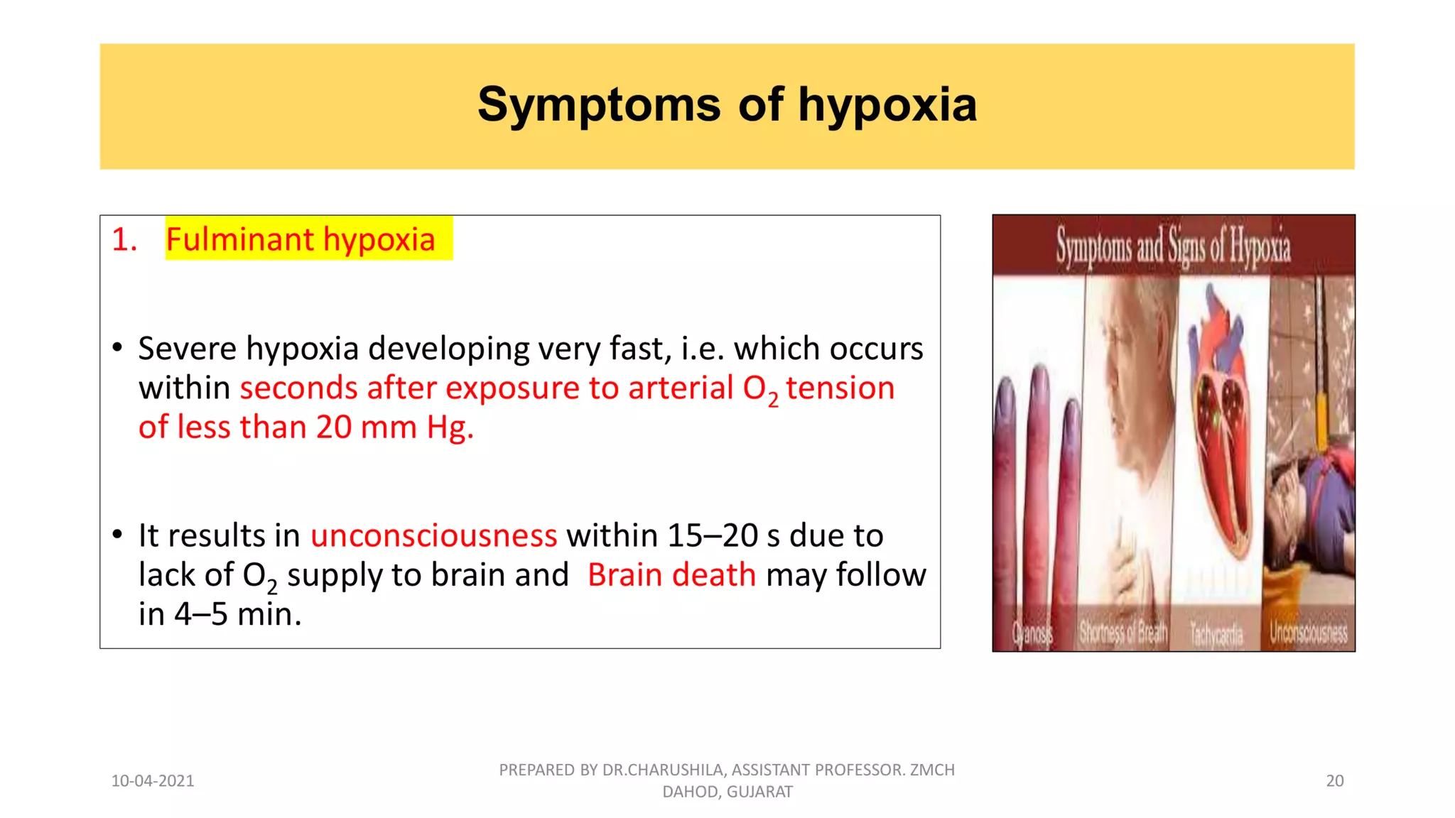 HYPOXIA: Applied aspect of respiratory sysstem | PDF