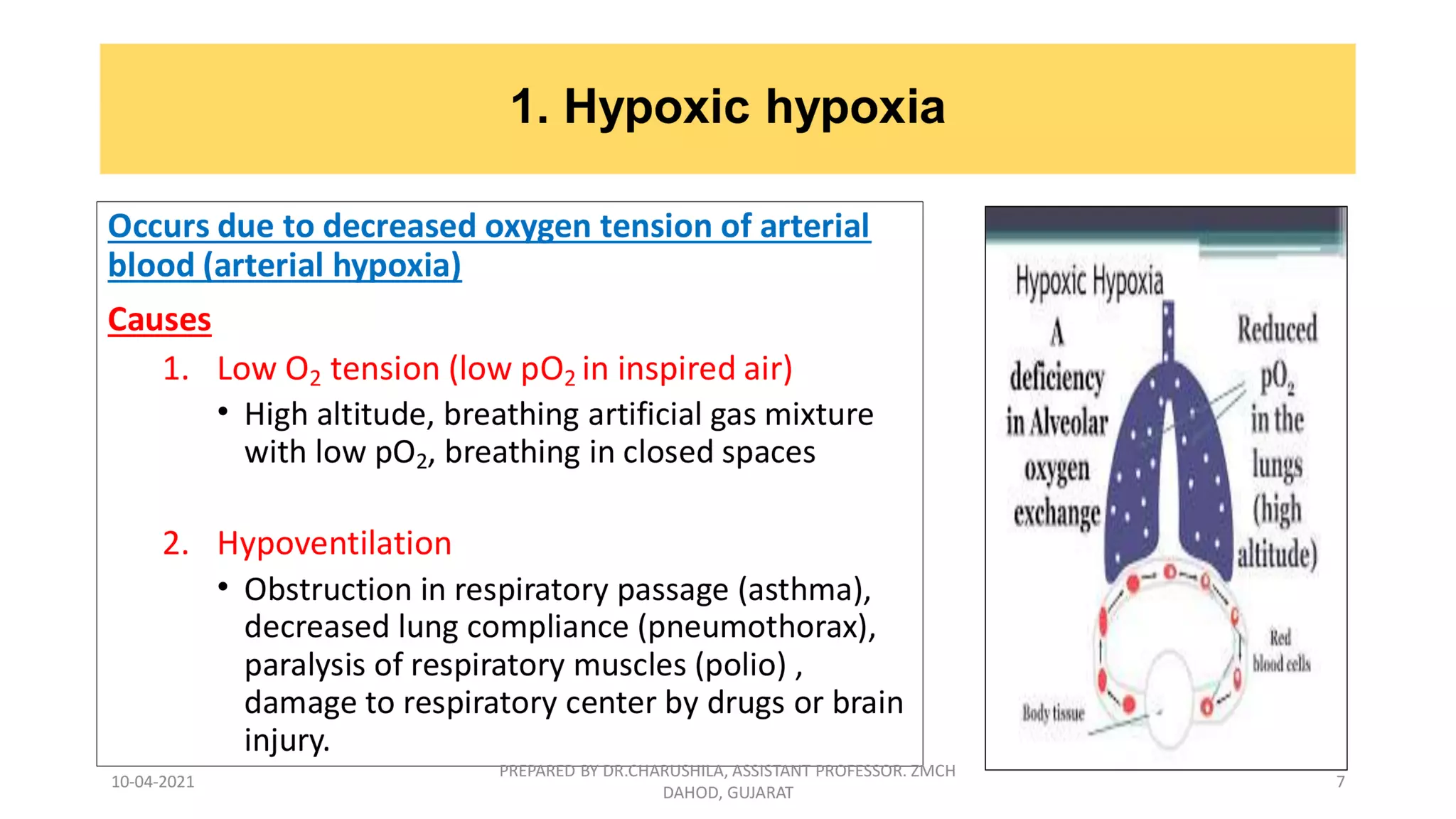 HYPOXIA: Applied aspect of respiratory sysstem | PDF
