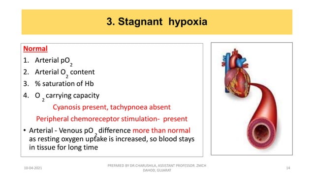 HYPOXIA: Applied aspect of respiratory sysstem | PDF