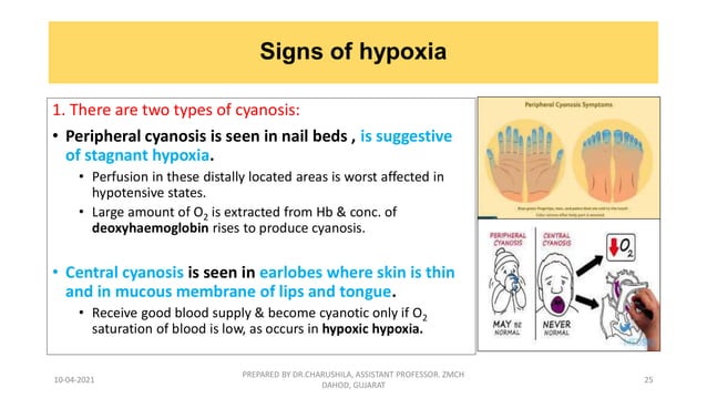 HYPOXIA: Applied aspect of respiratory sysstem | PDF