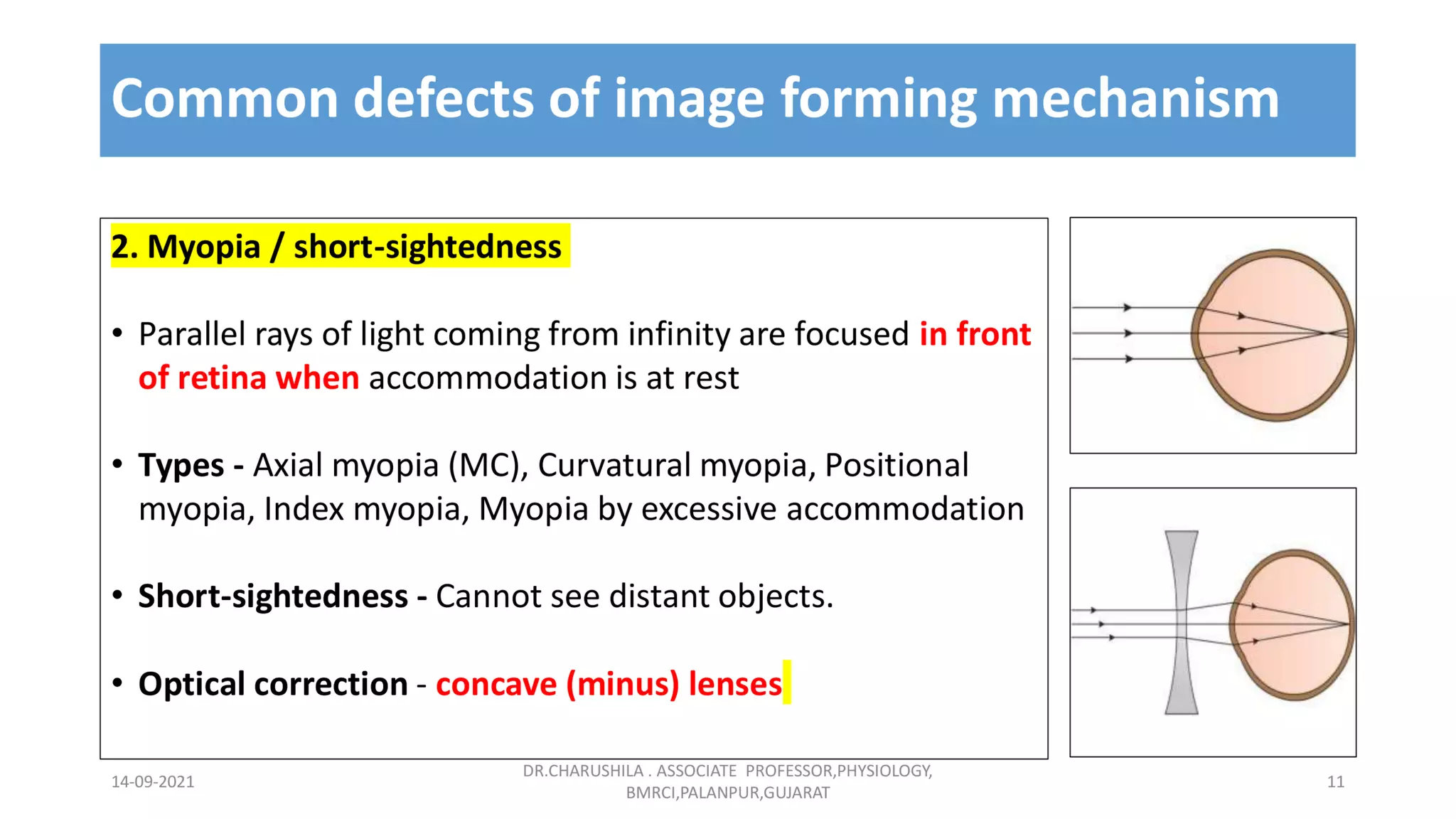 Lecture 1/2022 Special senses , Vision 1- Basics of vision, Optics of ...