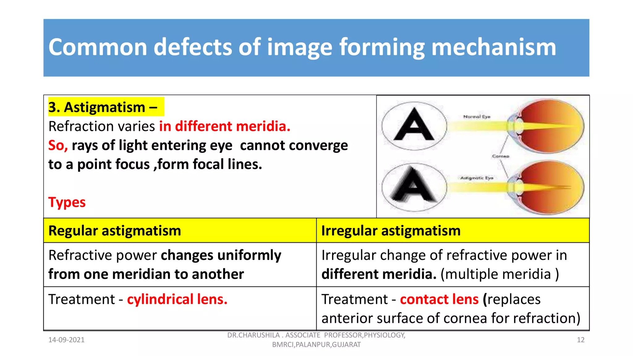 Lecture 1/2022 Special senses , Vision 1- Basics of vision, Optics of the eye , Accommodation ...
