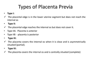 Lecture 16 APH.pptx. power point lecture | PPT