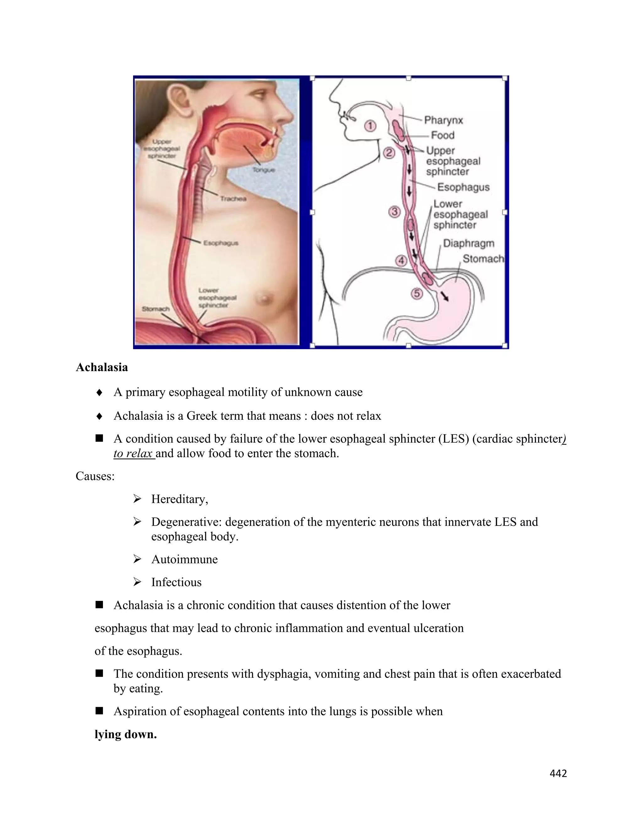 Lecture 16 esophagus and stomach disorders - Pathology | PDF