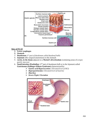 Lecture 16 esophagus and stomach disorders - Pathology | PDF