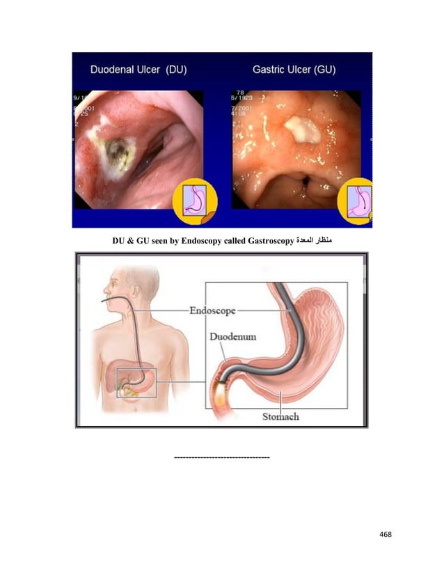 Lecture 16 esophagus and stomach disorders - Pathology | PDF