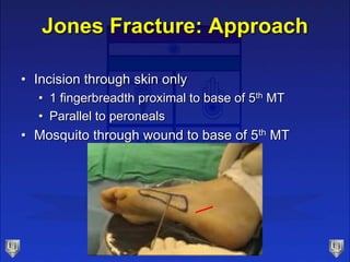 Lecture 16 parekh jones | PPTX